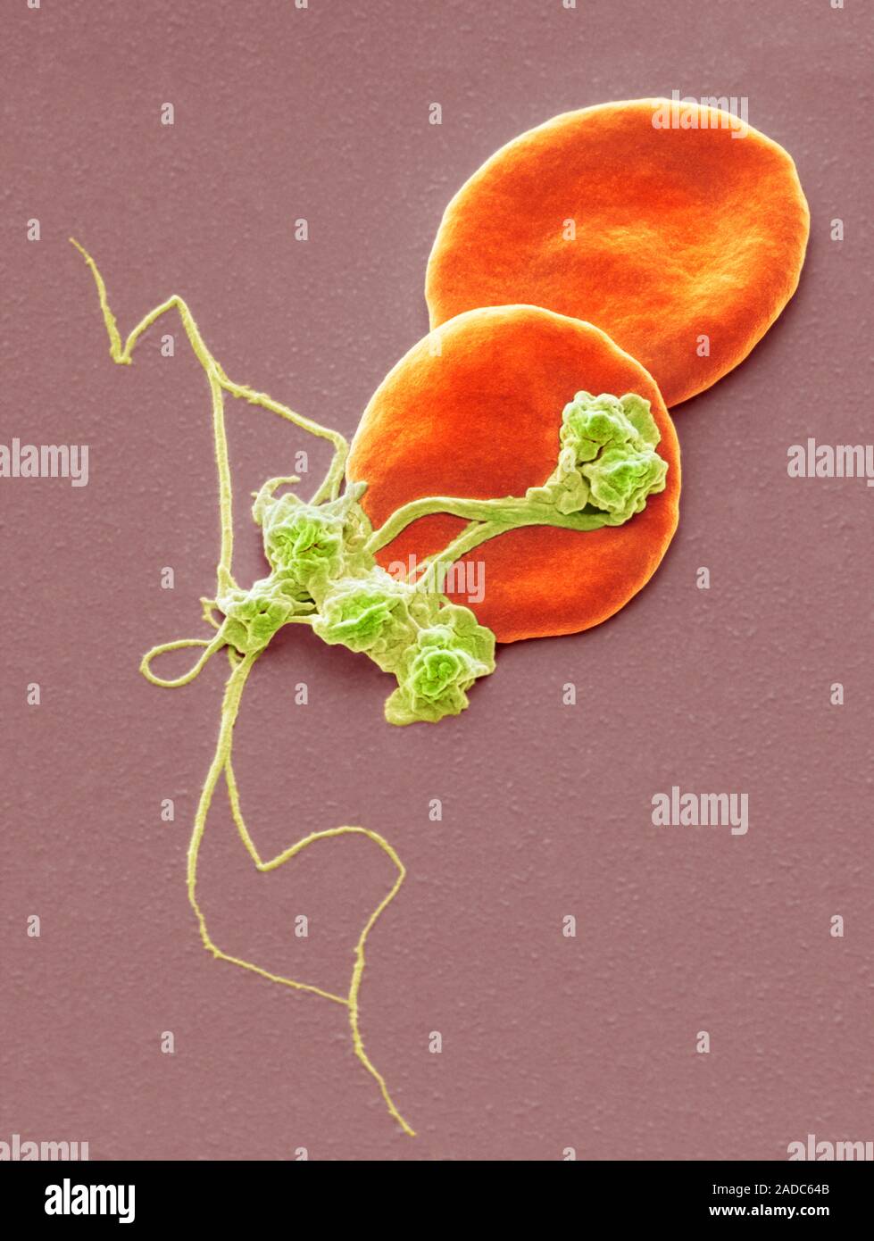 Rote Blutkörperchen und Blutplättchen. Farbiges scannen electon ...