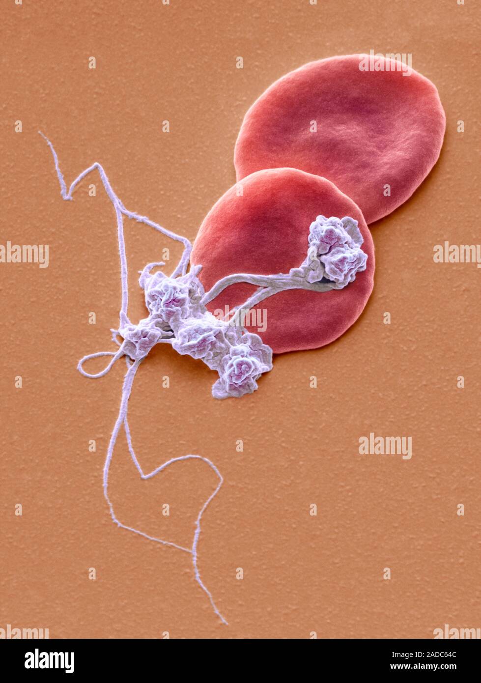 Rote Blutkörperchen und Blutplättchen. Farbiges scannen electon ...