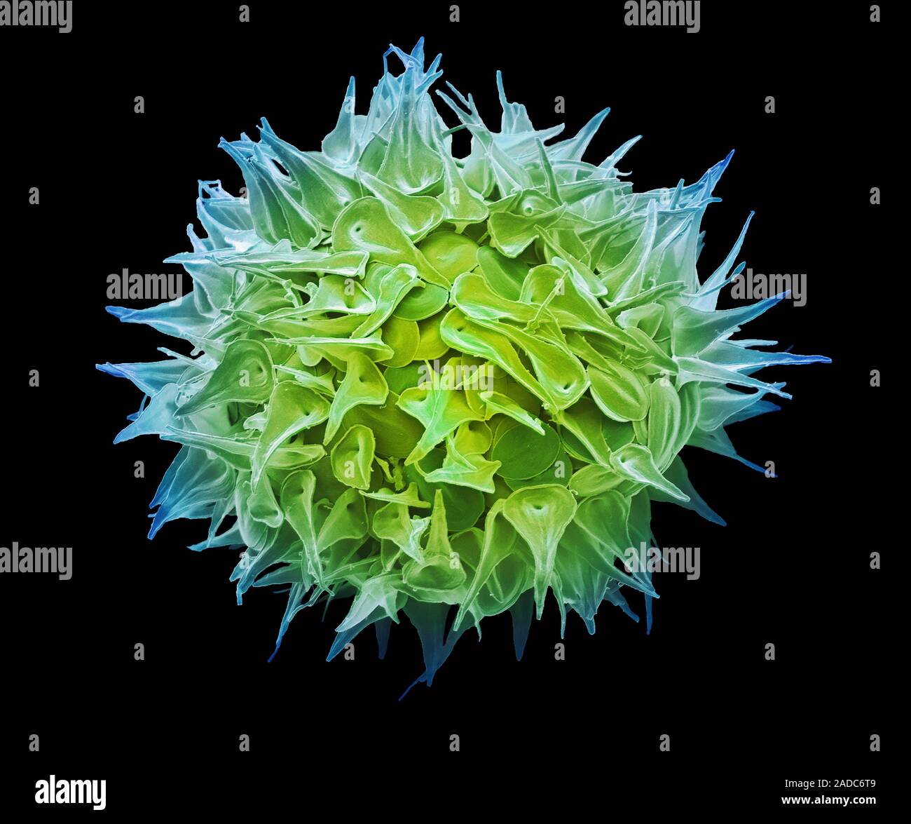 Pterocystis heliozoan. Farbige Scanning Electron Micrograph (SEM) der ...