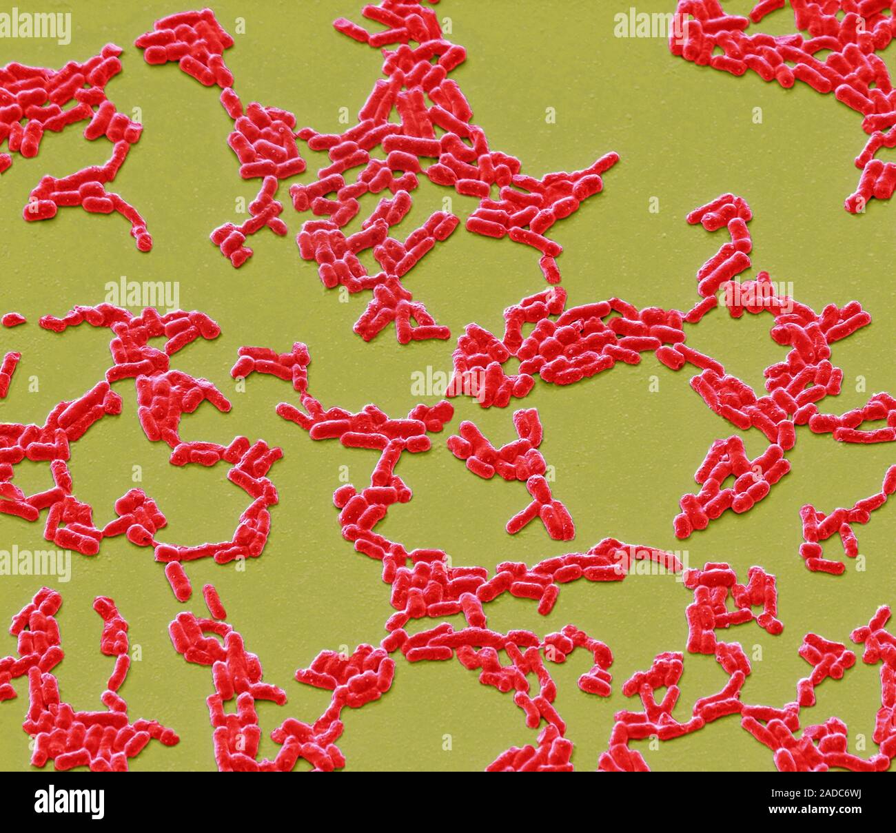Salmonella Typhi. Farbige Scanning Electron Micrograph (SEM) von ...