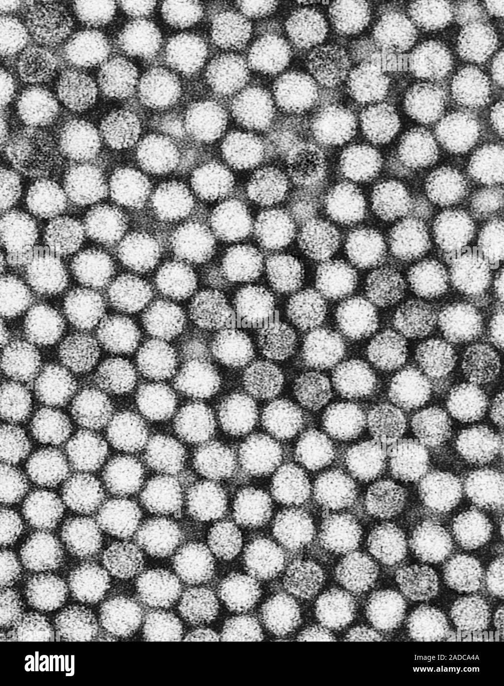 Hepatitis-B-Virus (HBV) ist die Ursache der Serum Hepatitis oder ...