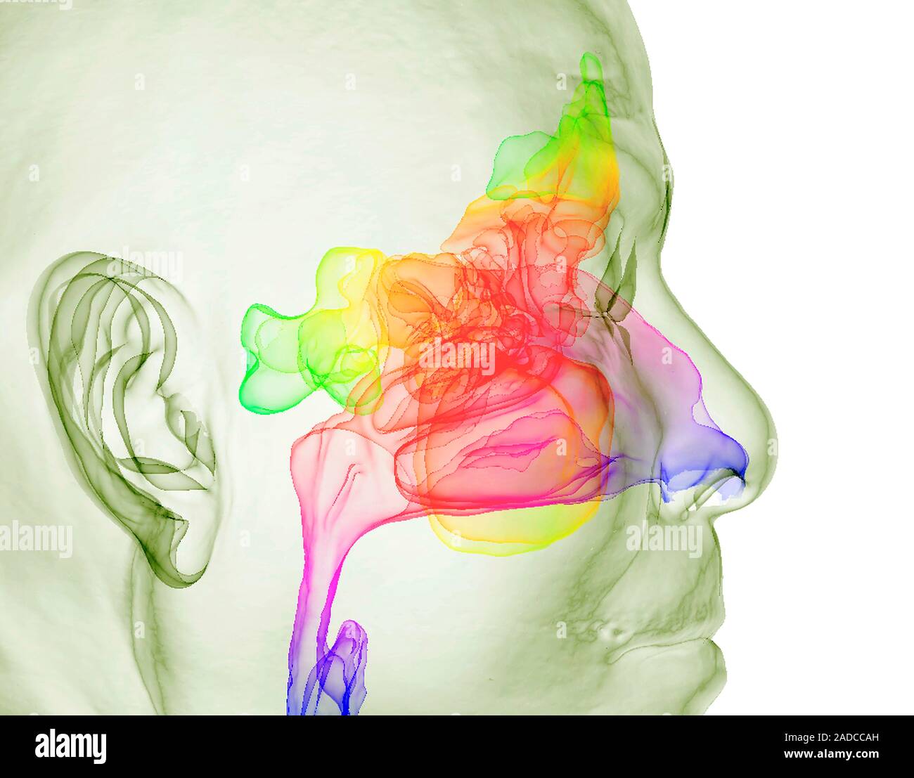Kehle und Nasennebenhöhlen. 3D-Computertomographie (CT)-Scan des Nasen-Rachen-Raumes (obere ...