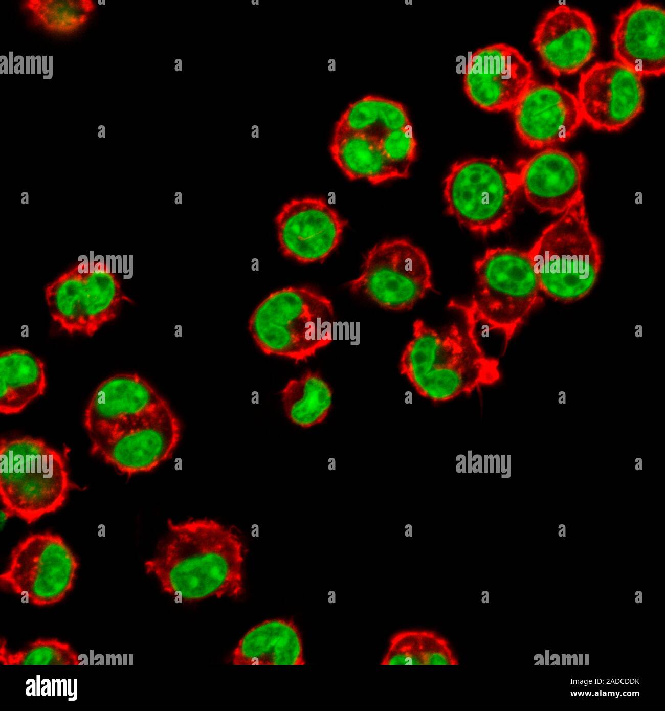 Makrophagen, konfokales Fluoreszenz Licht schliffbild. Makrophagen sind ...