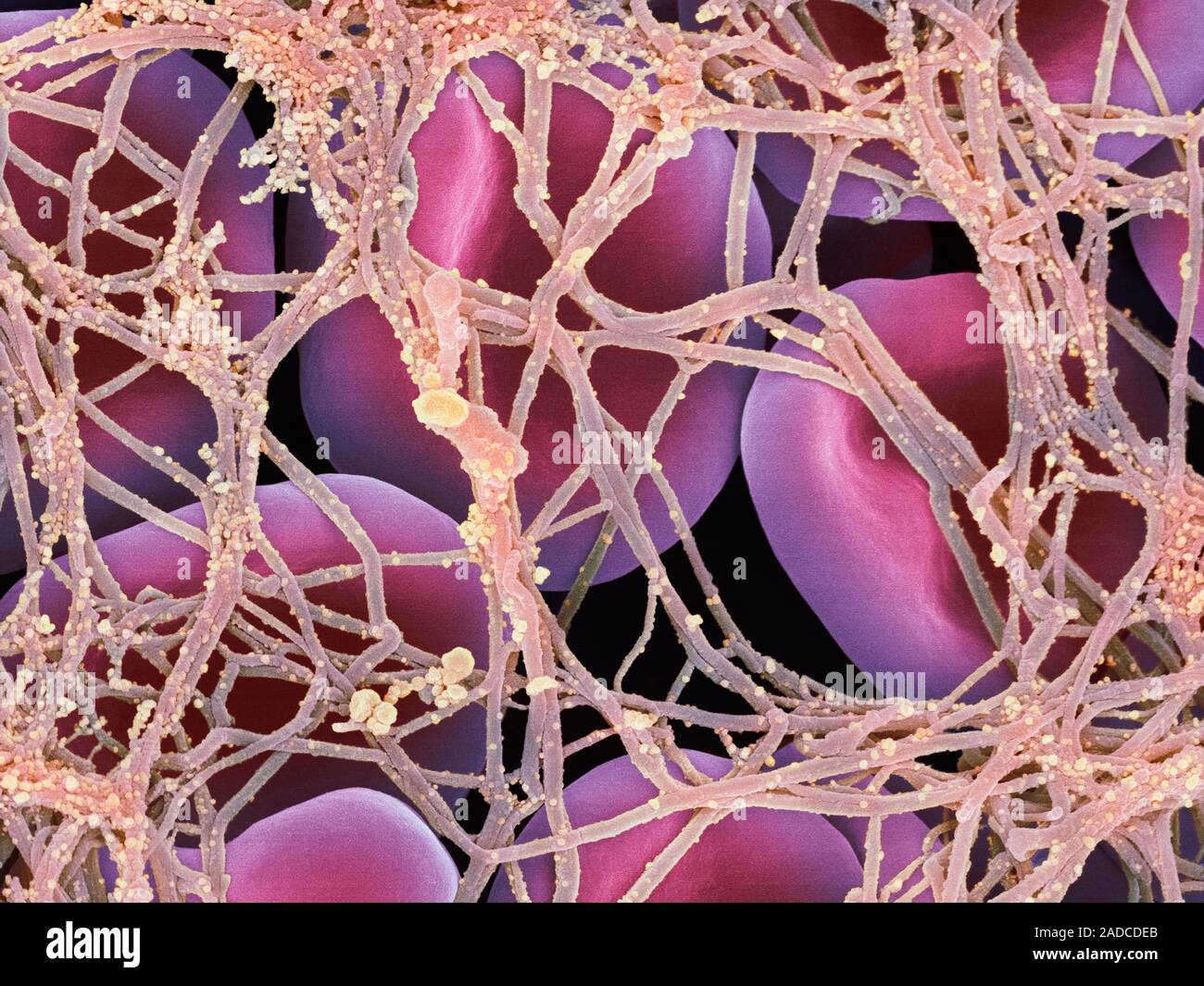 Farbige Scanning Electron Micrograph der menschlichen roten ...
