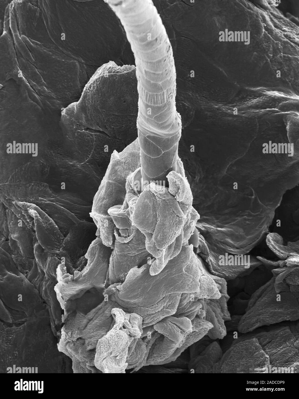Die menschliche Haut (Epidermis) mit Haaren aus Haarfollikel, Scanning ... Die menschliche Haut (Epidermis) mit Haaren aus Haarfollikel, Scanning ...