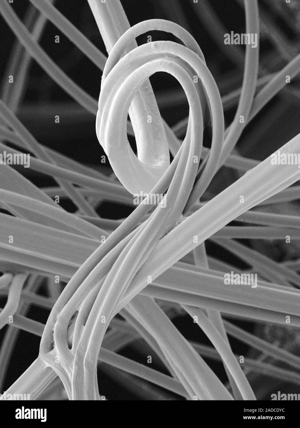 Scanning Electron Micrograph (SEM) der Nördlichen Black Widow spider ...