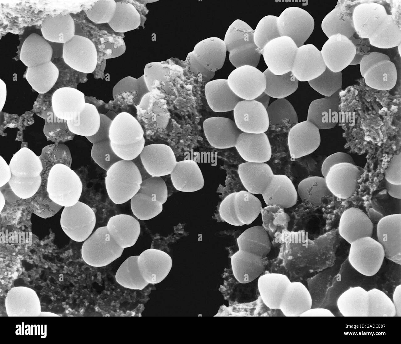 Scanning Electron Micrograph (SEM) von Enterococcus faecium (auch ...