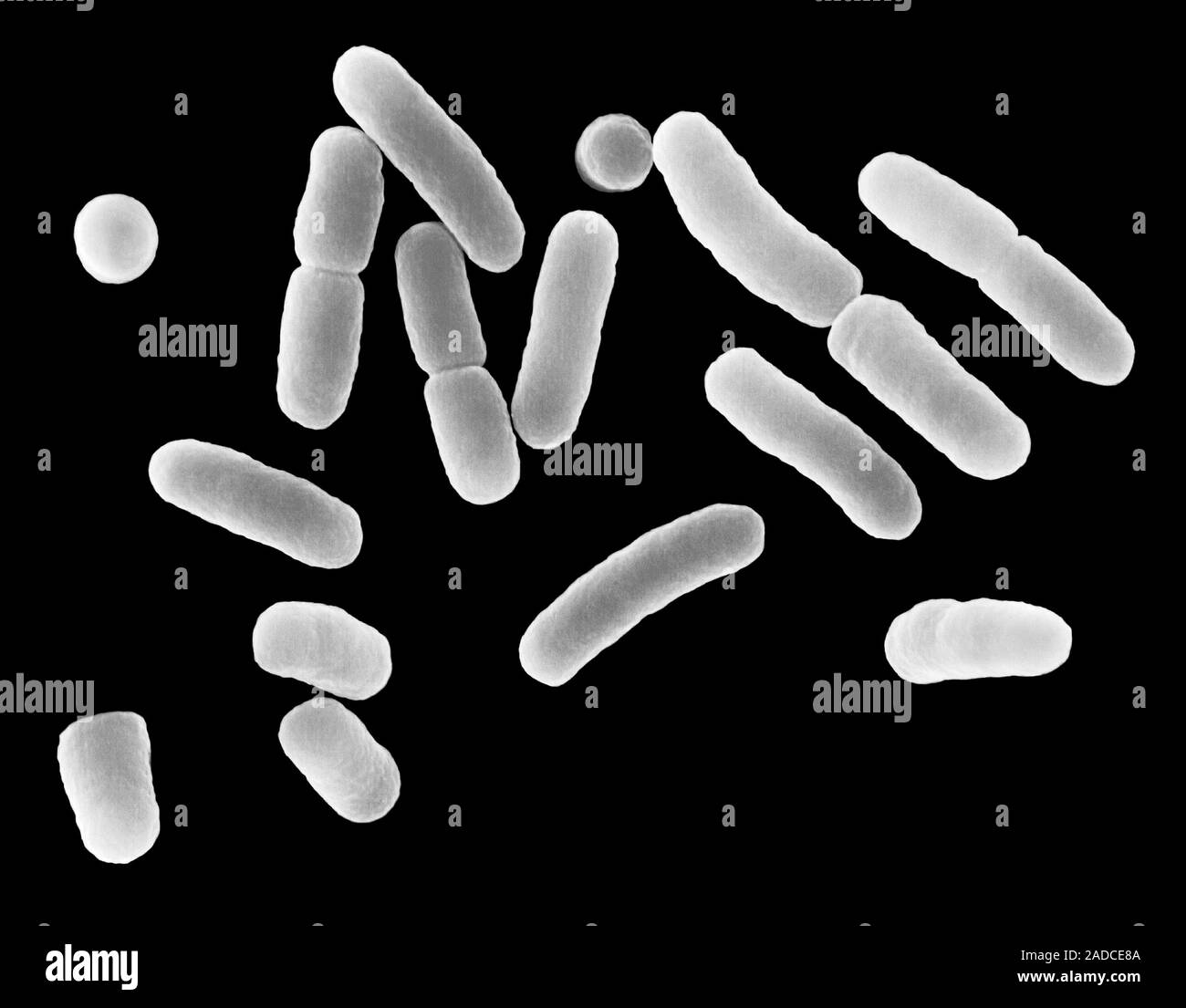 Scanning Electron Micrograph (SEM) von E. coli (Escherichia coli ...