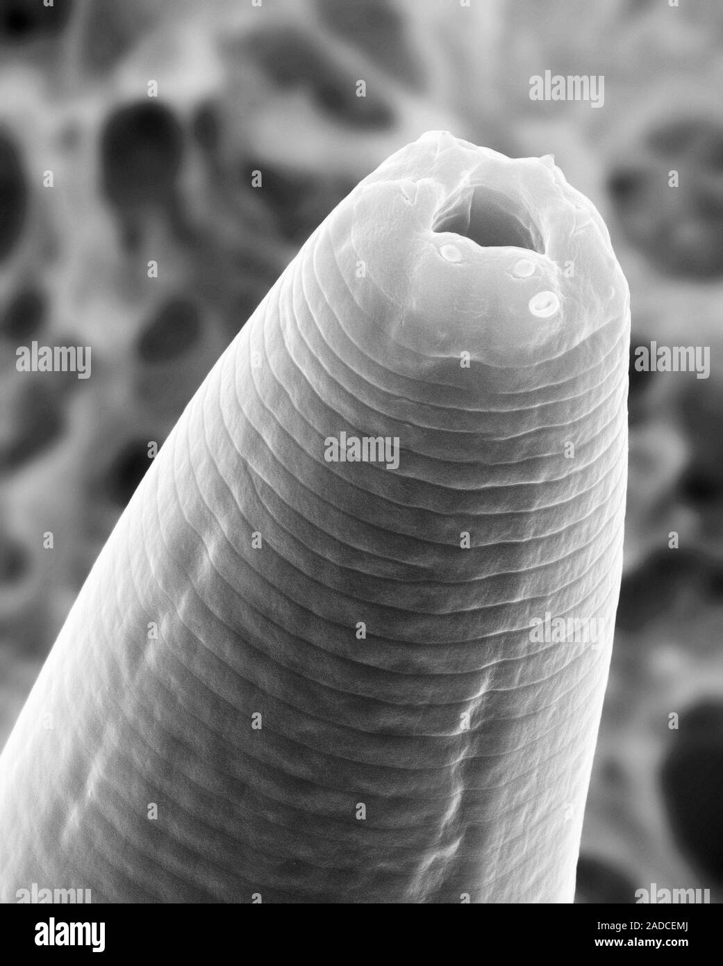 Scanning Electron Micrograph (SEM) von frei lebenden Boden, anterior ...