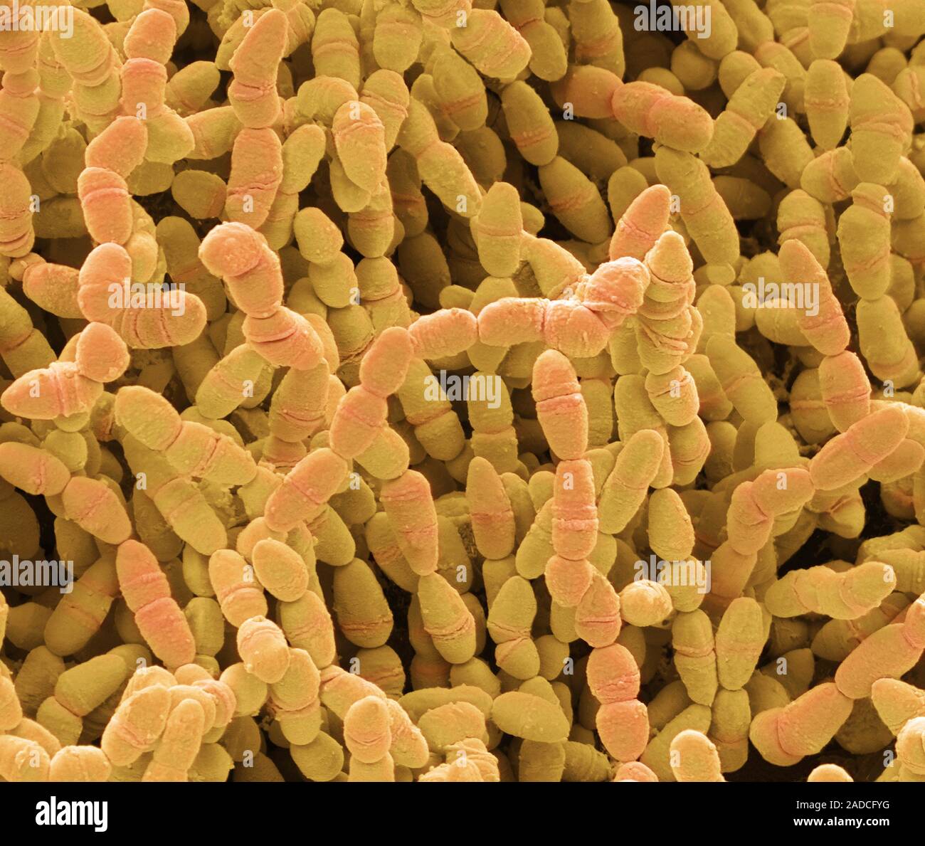 Staphylococcus epidermidis. Farbige Scanning Electron Micrograph (SEM ...