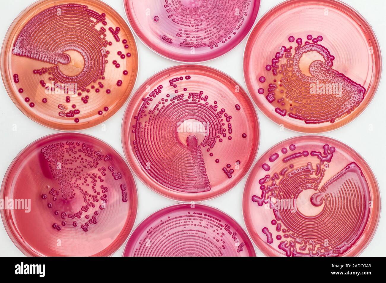 Bakterienkulturen in MacConkey Agar. Auswahl der Petrischalen mit ...