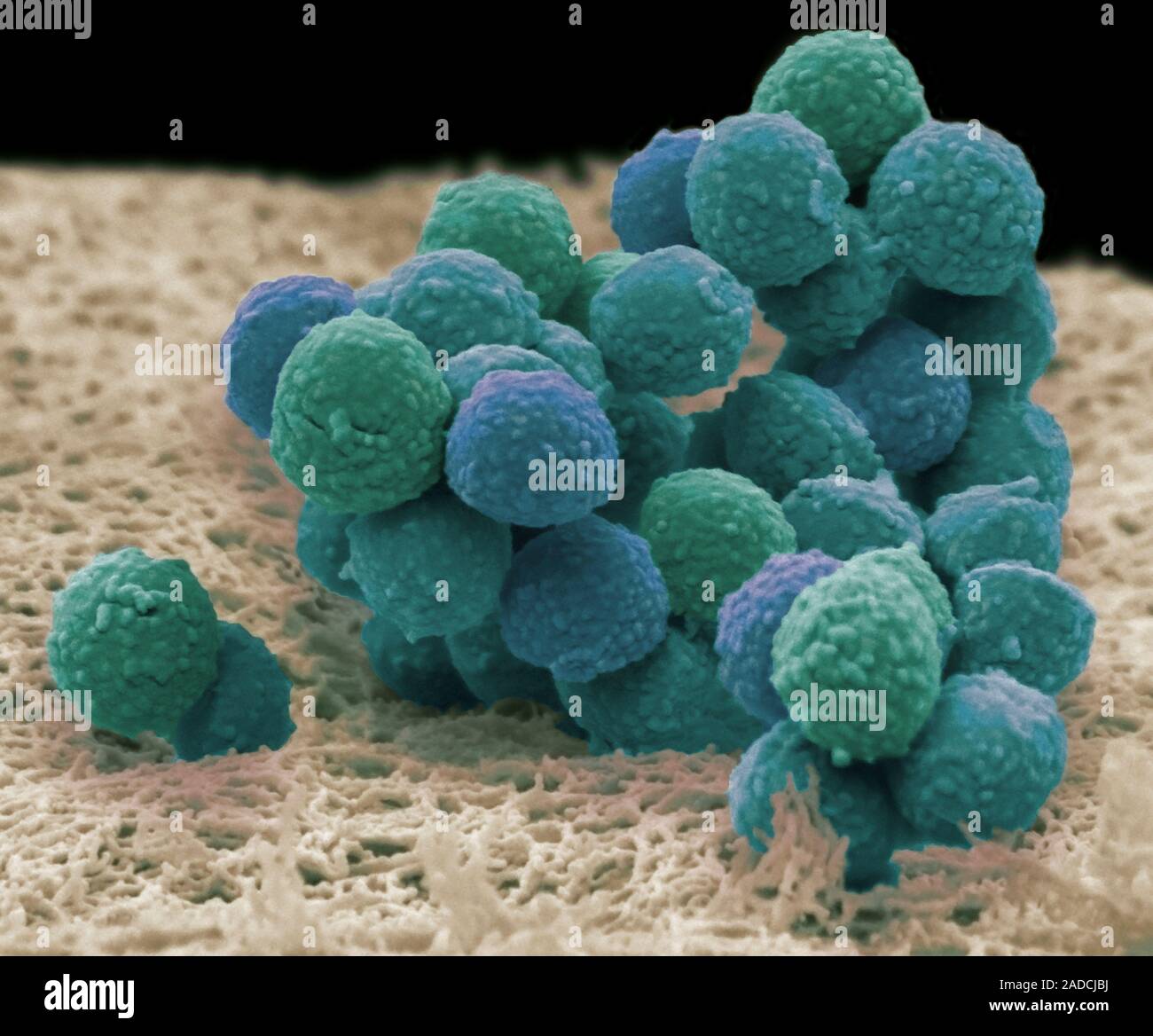 Staphylococcus epidermidis Bakterien. Farbige Scanning Electron ...