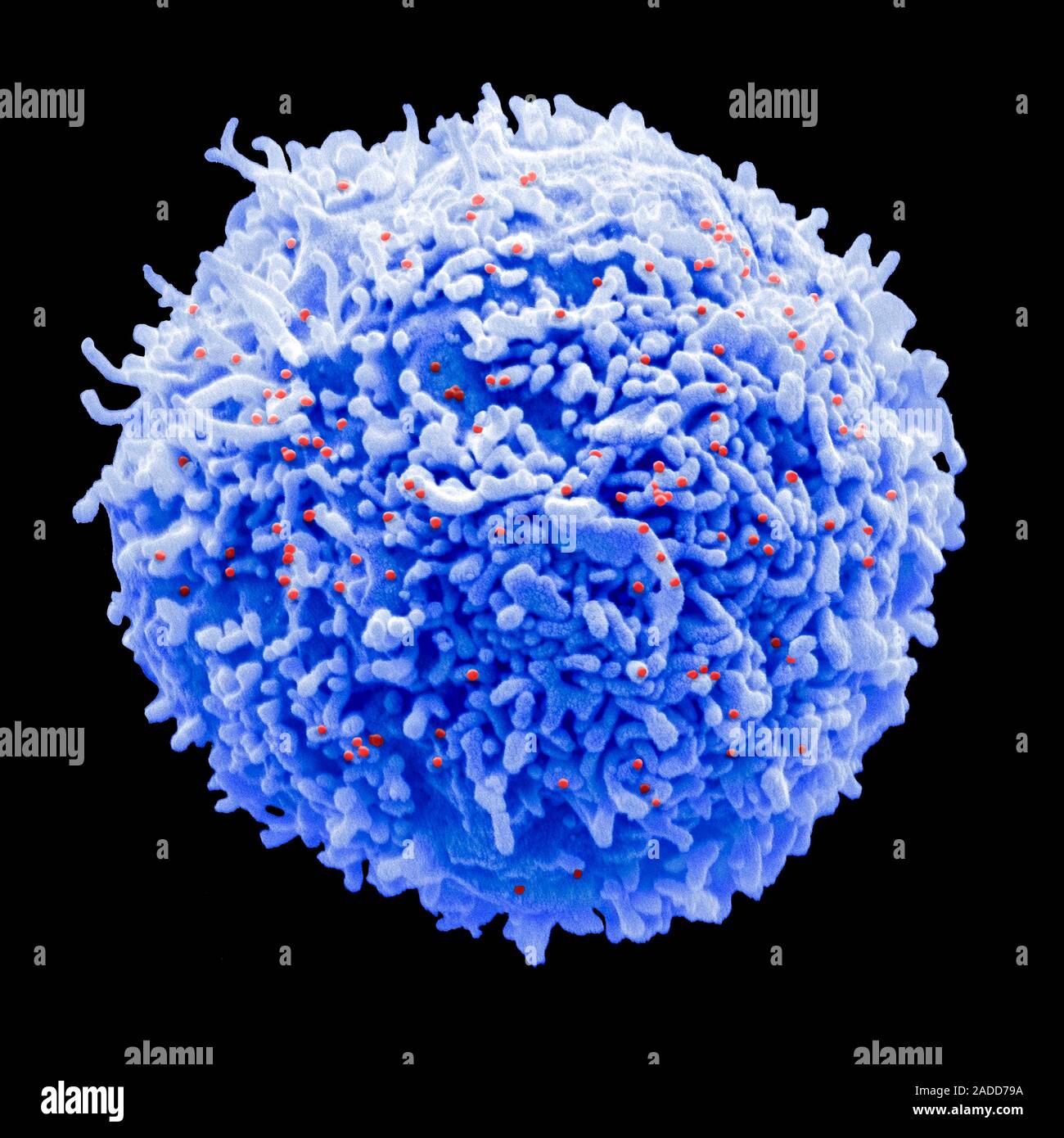 T-Zellen mit HIV infiziert. Farbige Scanning Electron Micrograph (SEM ...