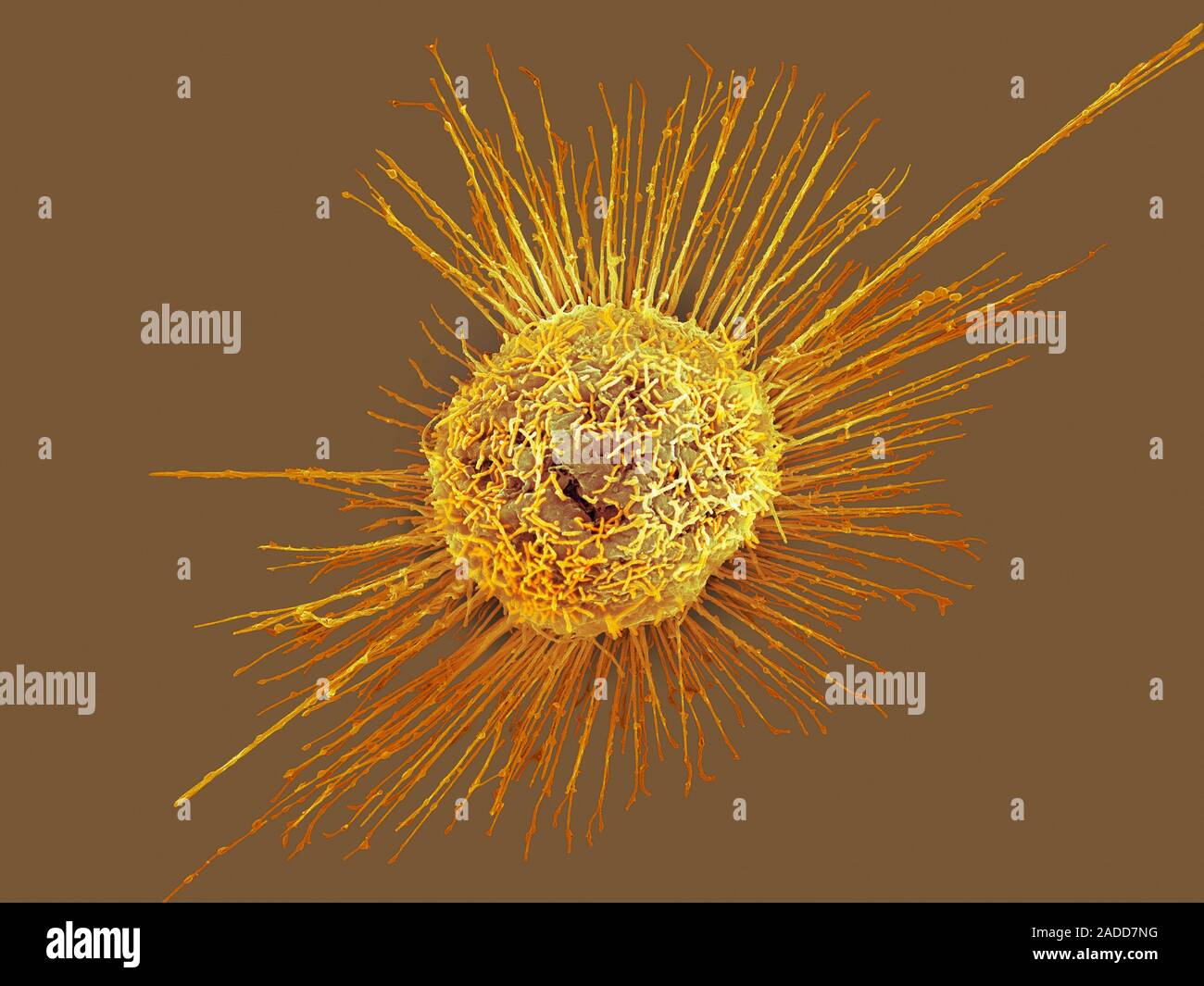 Farbige Scanning Electron Micrograph (SEM) von H1N1-Influenza (Grippe ...