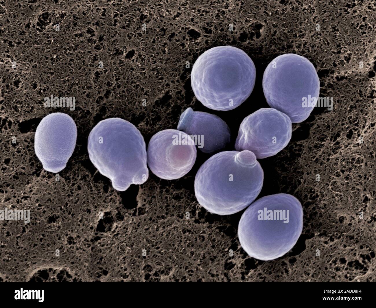 Farbige Scanning Electron Micrograph (SEM) von Candida albicans (Hefe ...