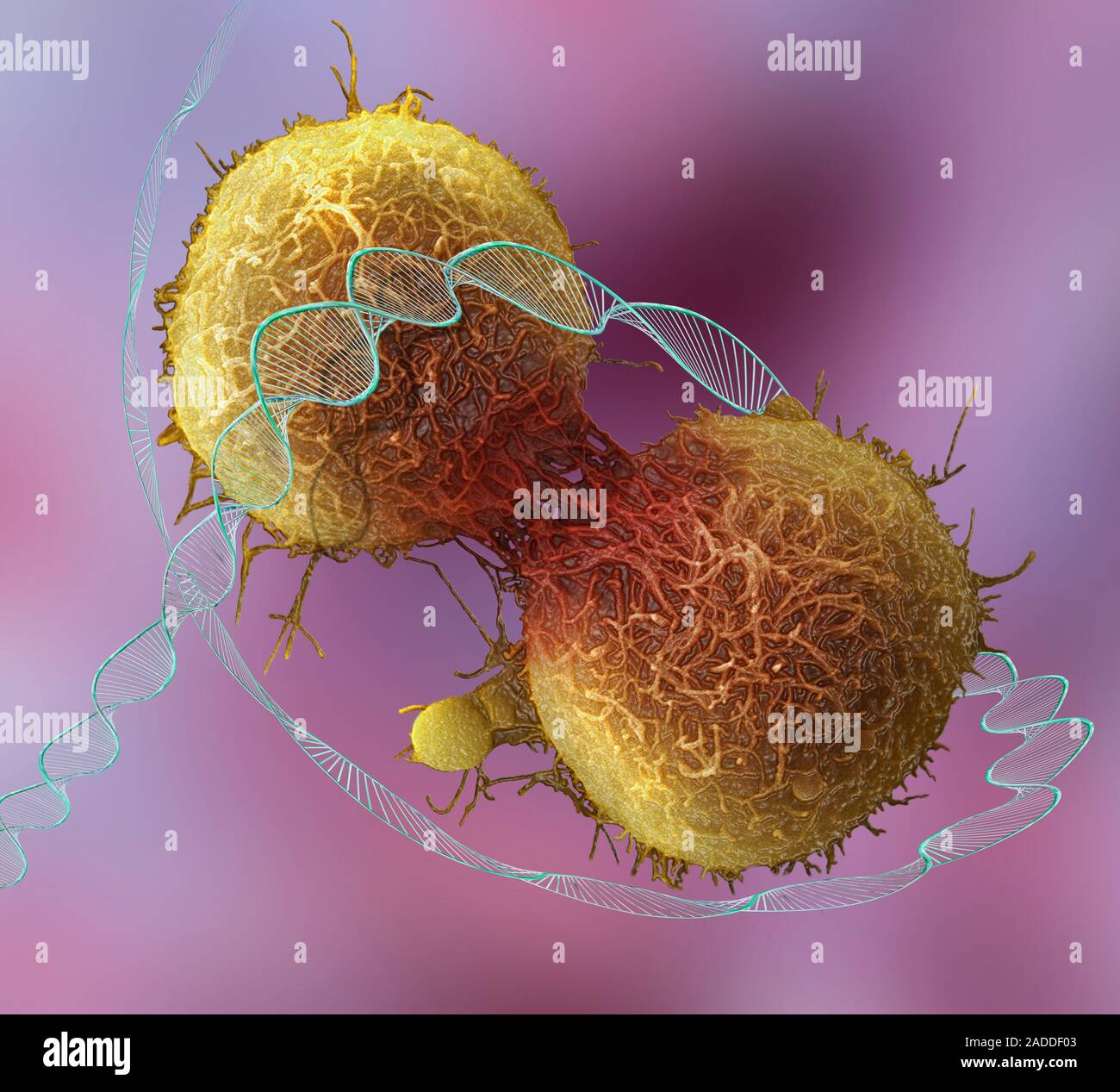Krebs und DNA, konzeptionelle zusammengesetzte Bild. Scanning Electron ...