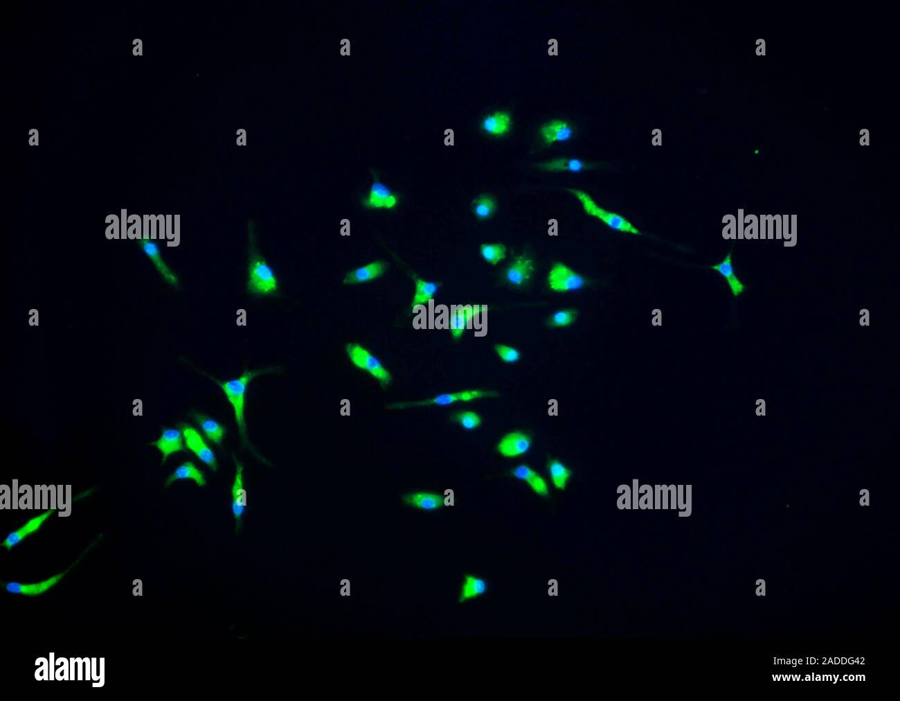 Mikroglia Zellen des Gehirns. Fluoreszenz Licht schliffbild Beispiele ...