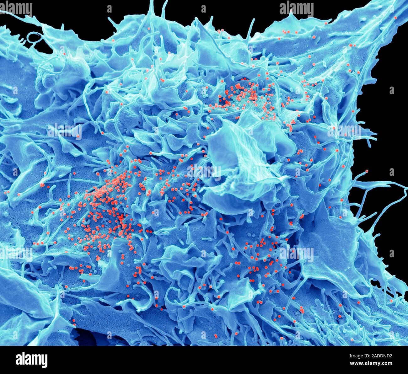 HIV-Infizierte 293 T-Zelle. Farbige Scanning Electron Micrograph (SEM ...