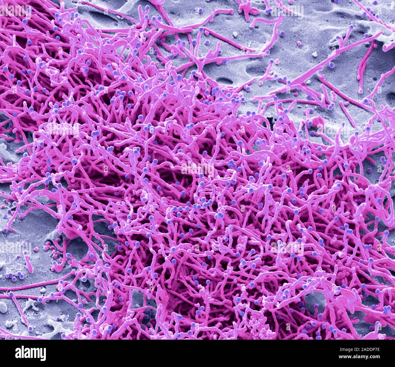HIV-Infizierte 293 T-Zelle. Farbige Scanning Electron Micrograph (SEM ...