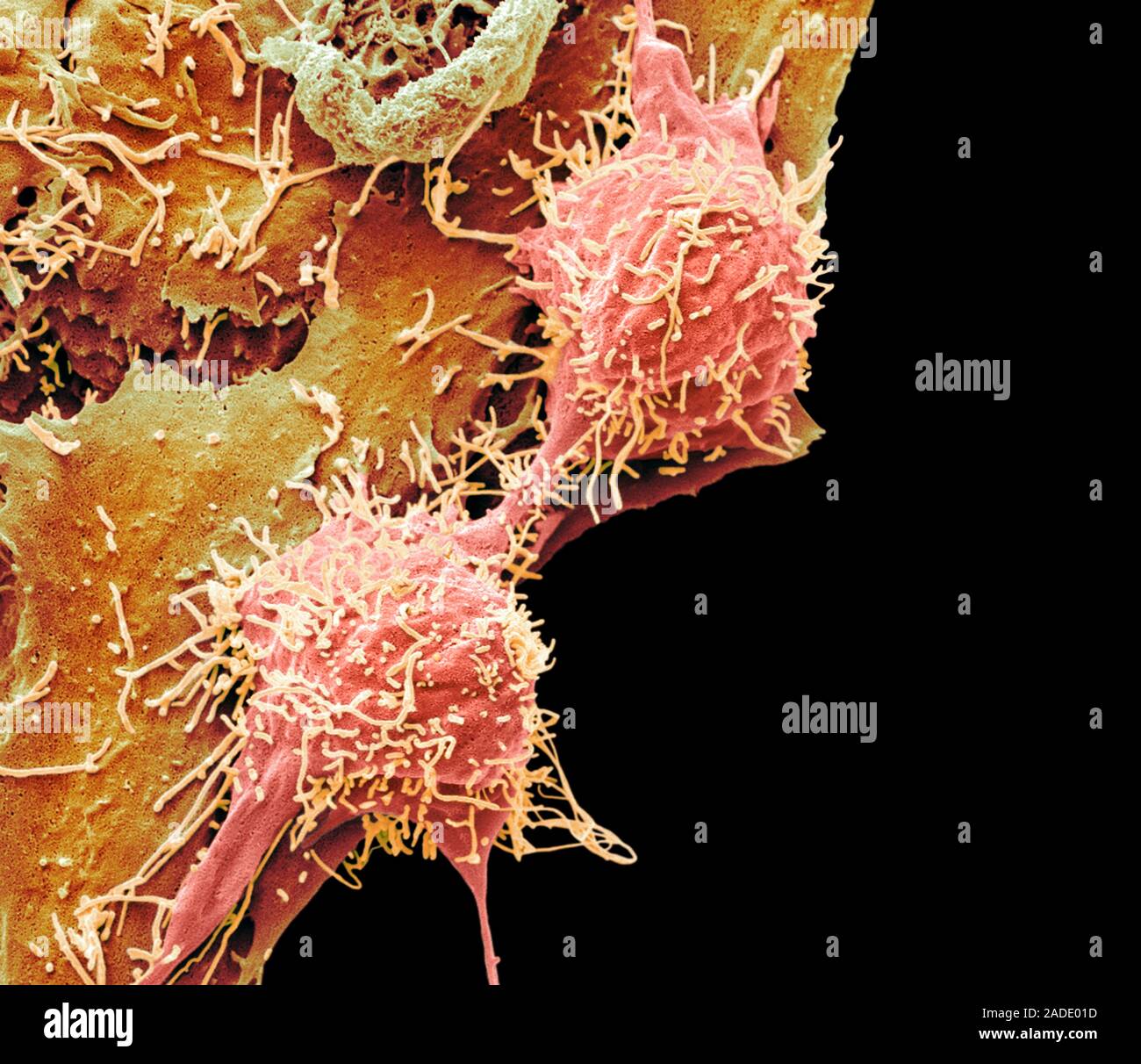Natürliche Killerzellen (NK-Zellen) Interaktion mit hepatom Zelle ...