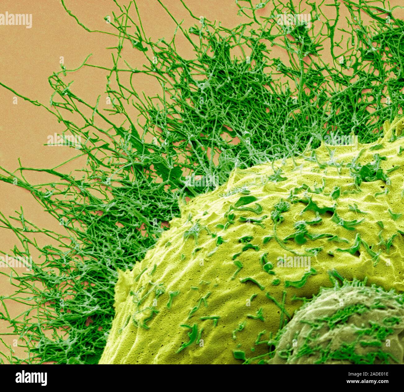 Farbige Scanning Electron Micrograph (SEM) einer menschlichen Zelle mit ...