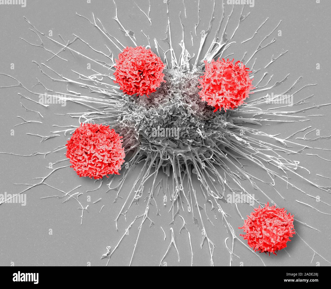 T-Zellen und Lungenkrebs Zelle. Composite farbige Scanning Electron ...