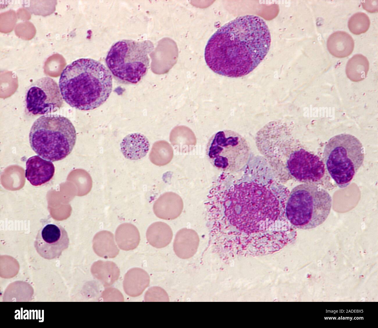 Knochenmark Blutzellen, Licht schliffbild. Knochenmark ist einer der ...
