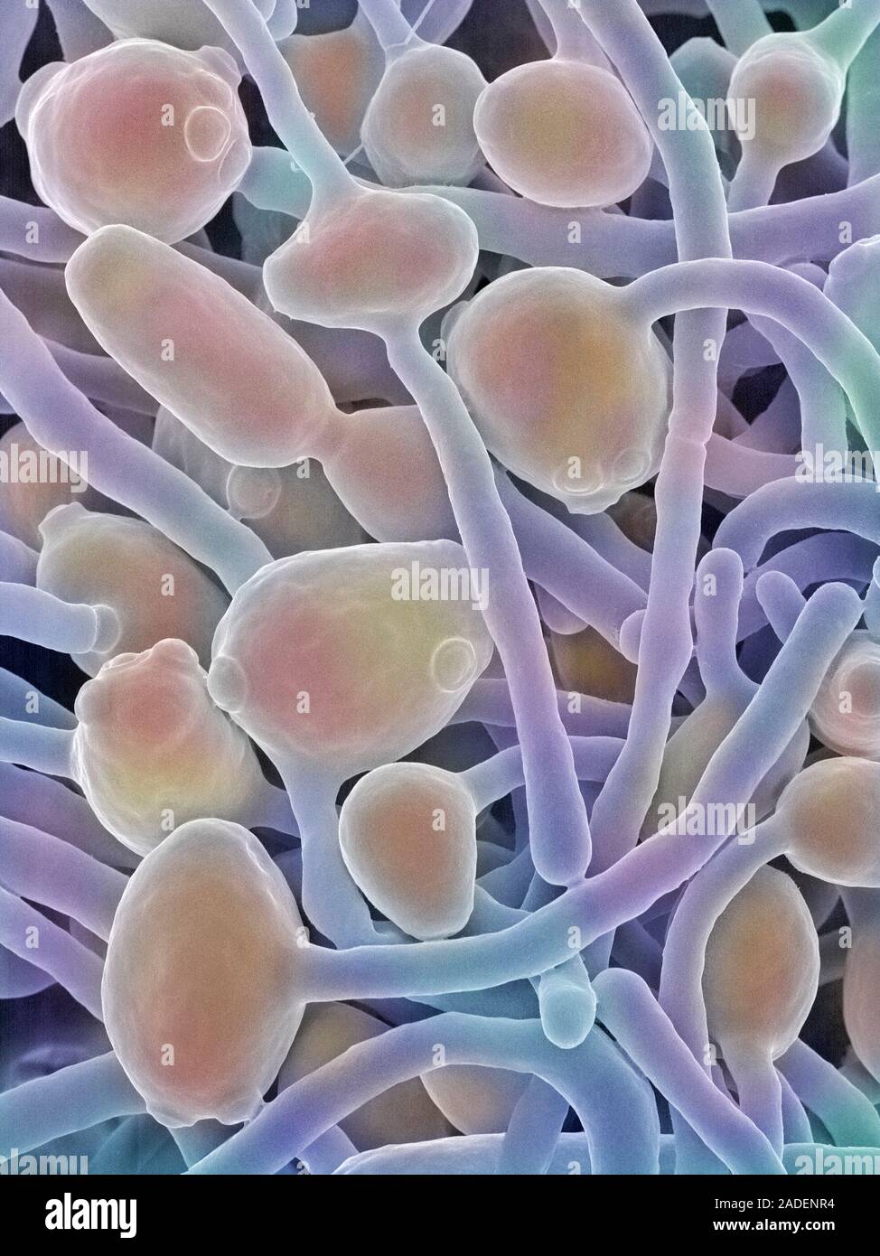 Die Hefe Candida albicans und Hyphen, farbige Scanning Electron ...