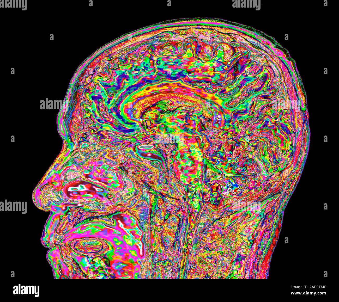 Menschlichen Kopf und Gehirn. Farbige 3D-Magnetic Resonance Imaging ...