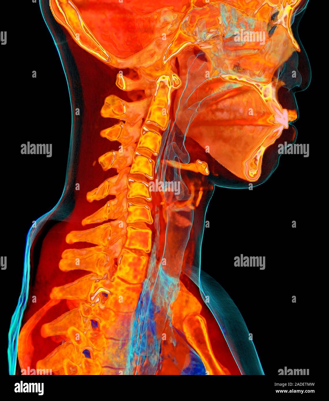 Menschlichen hws Anatomie. 3D-Computertomographie (CT) der Anatomie des ...