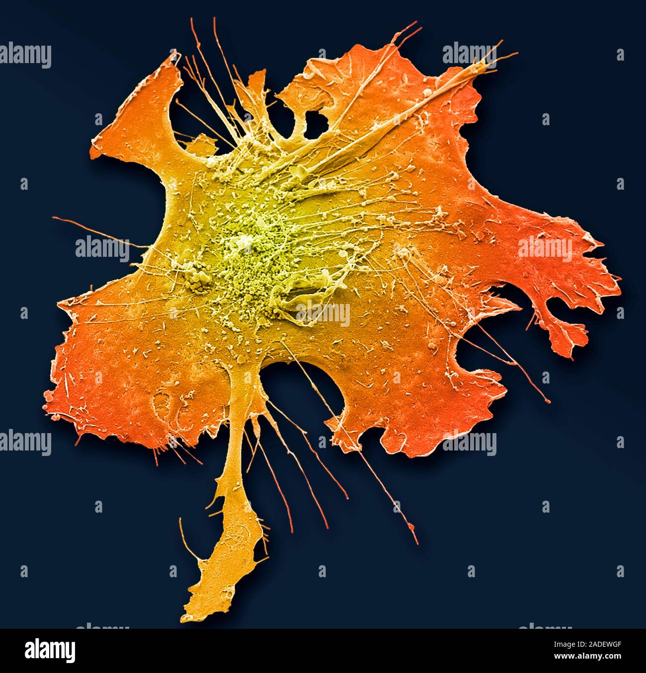 Osteoblast Knochen Zelle. Farbige Scanning Electron Micrograph (SEM ...
