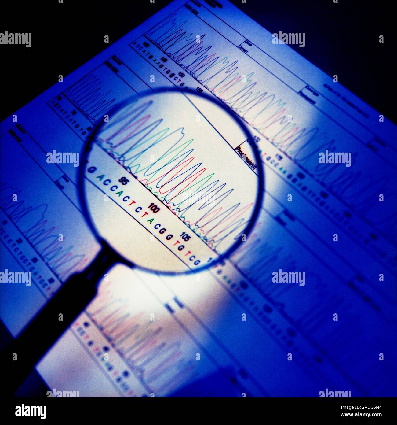 Die DNA-Analyse. Lupe über ein Diagramm mit den Ergebnissen der DNA ...