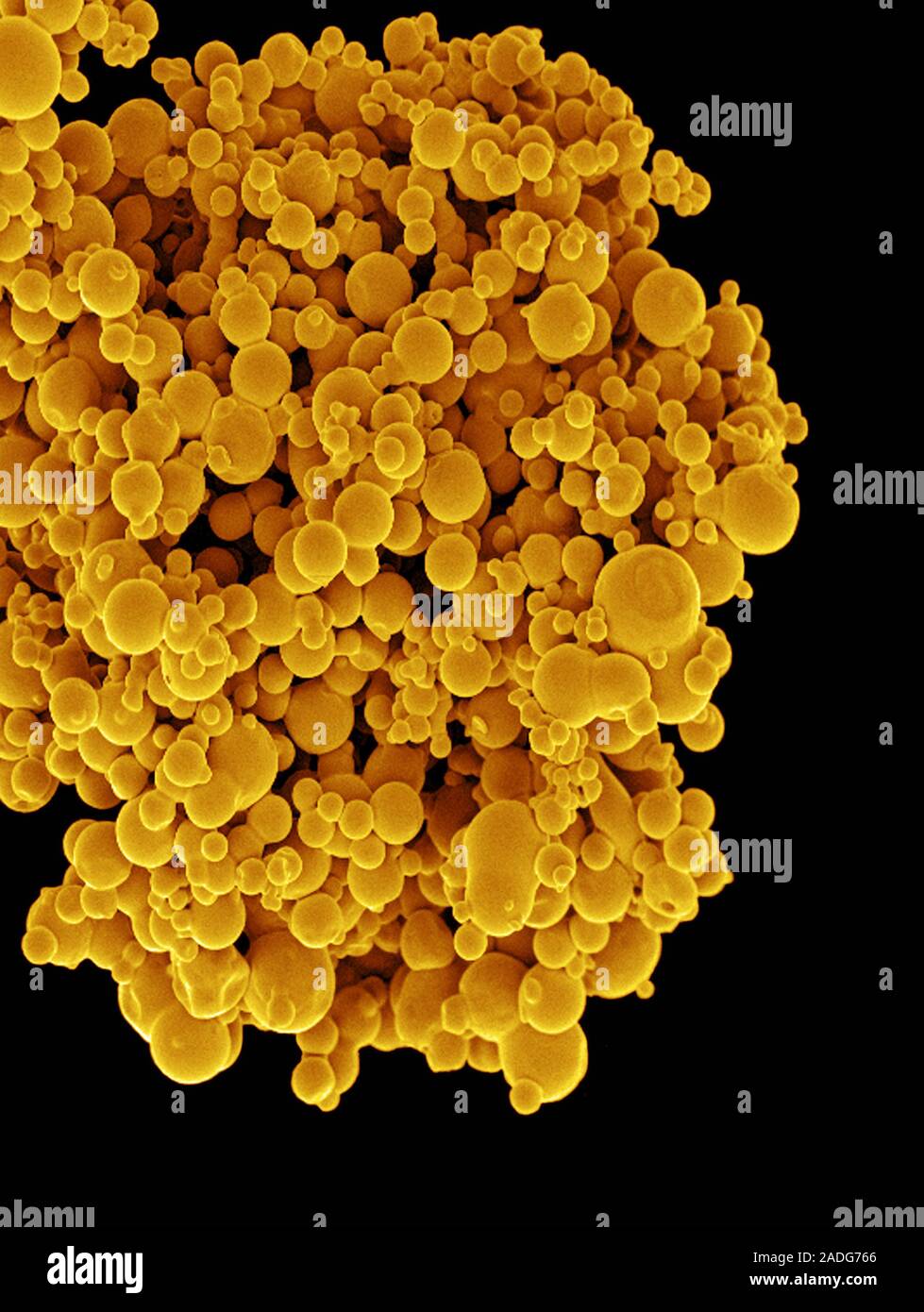 Liposomen Vesikel. Farbige Scanning Electron Micrograph (SEM) von ...