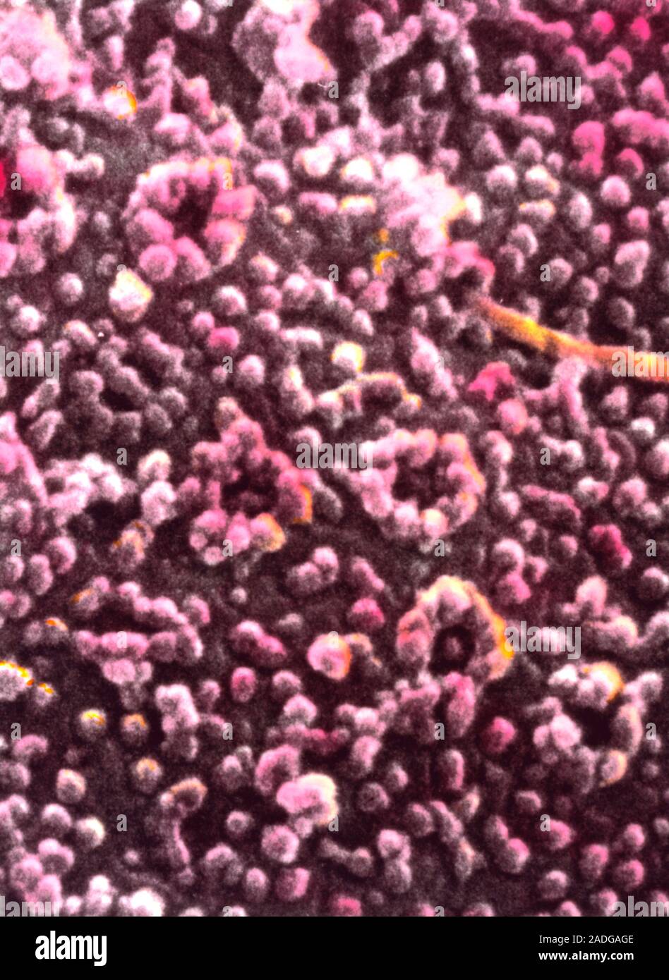 Kernporen. Farbige hochauflösende Scanning Electron Micrograph von ...