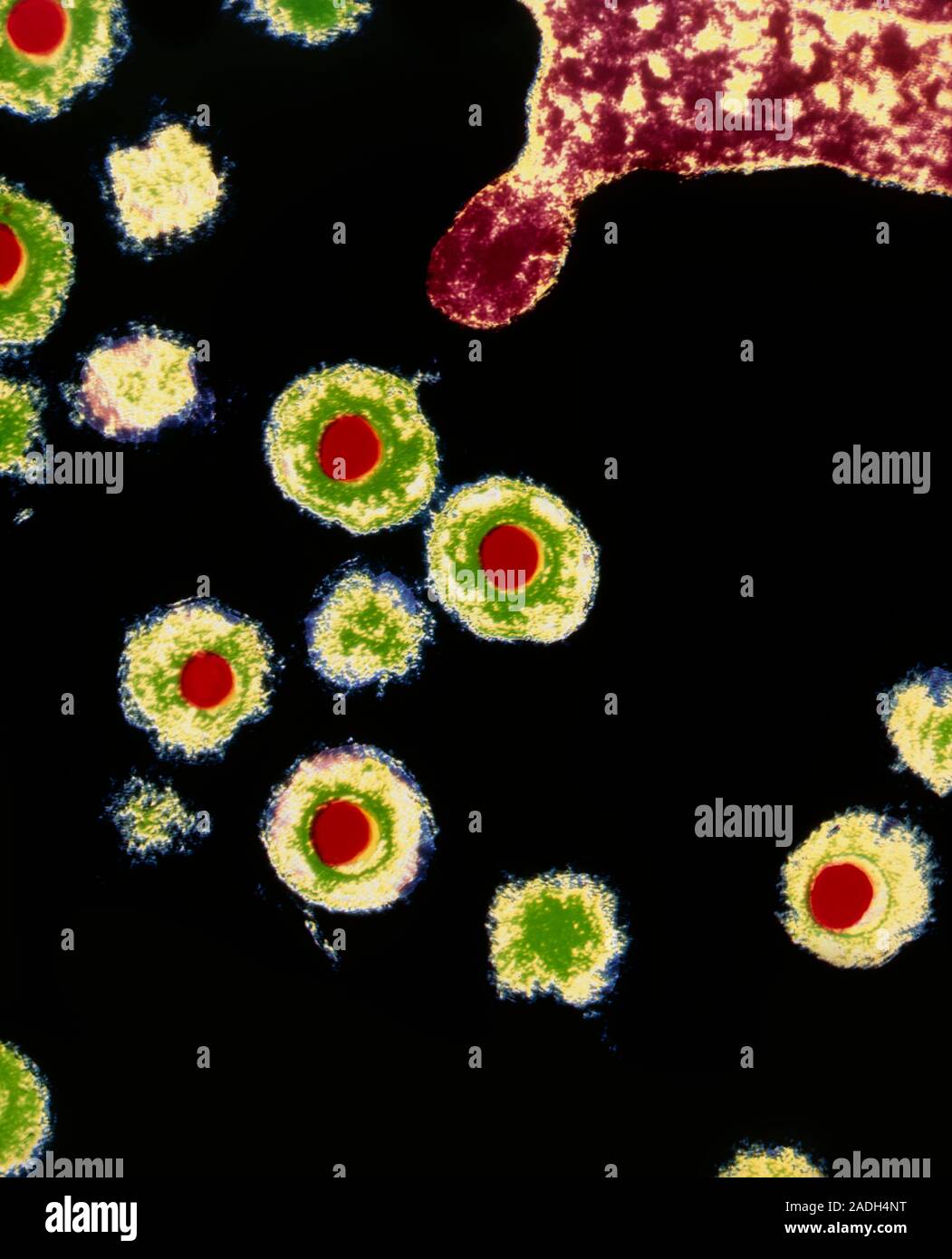Menschliches Herpesvirus Typ 6. Farbige Transmission Electron ...