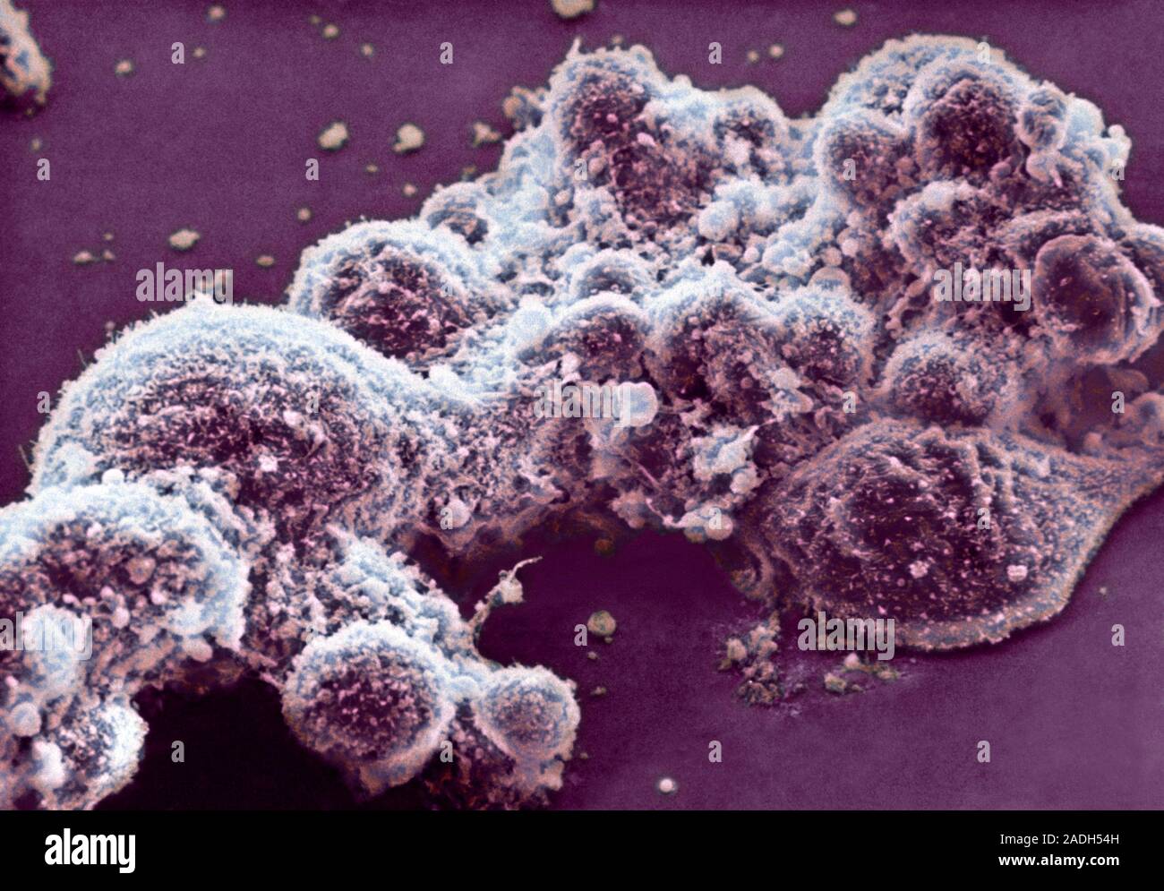 Infektion mit Herpes-simplex-Virus. Farbige Scanning Electron ...