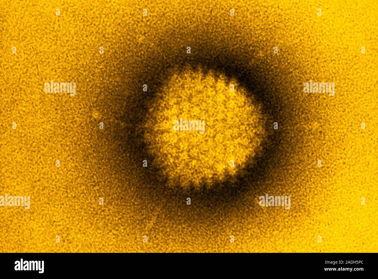 Falsche Farbe Transmission Electron Micrograph eines Adeno Virus, um ...