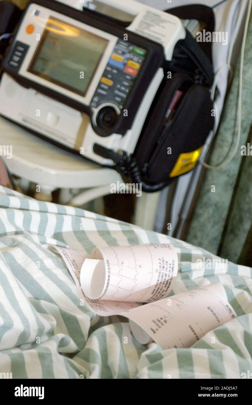 Elektrokardiogramm liegend auf Bett des Patienten. Dies ist ein ...