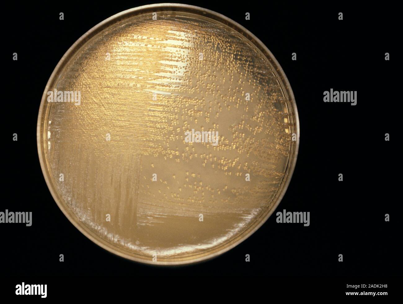 Pest Bakterien. Petrischale mit kultivierten Kolonien von Yersinia ...