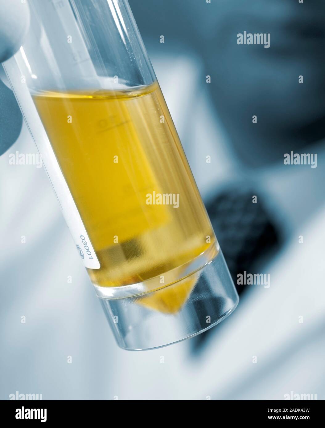 Urinprobe. Labortechniker Holding das Probenröhrchen mit dem Muster im ...