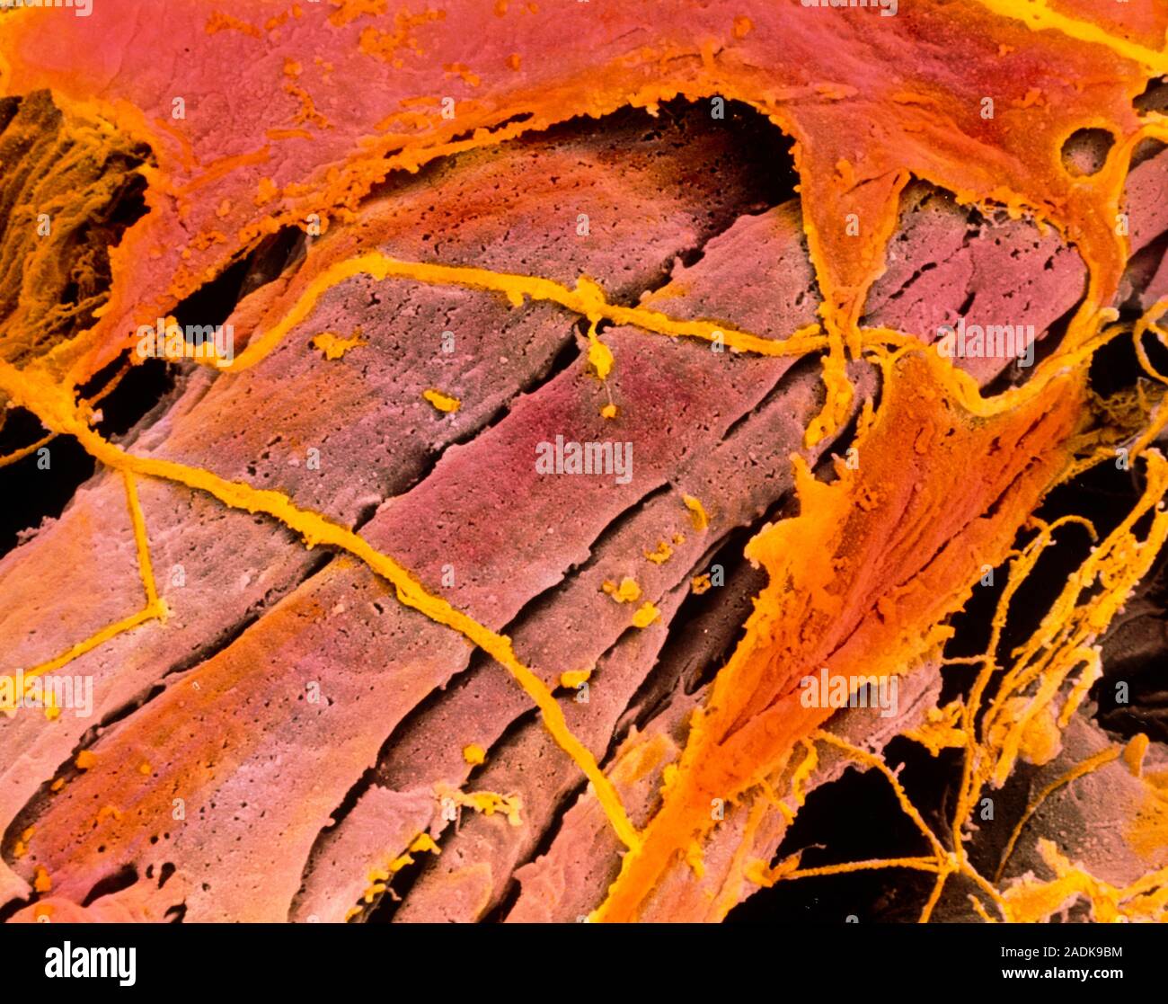 Der glatten Muskulatur in die Eileiter. Farbige Scanning Electron ...