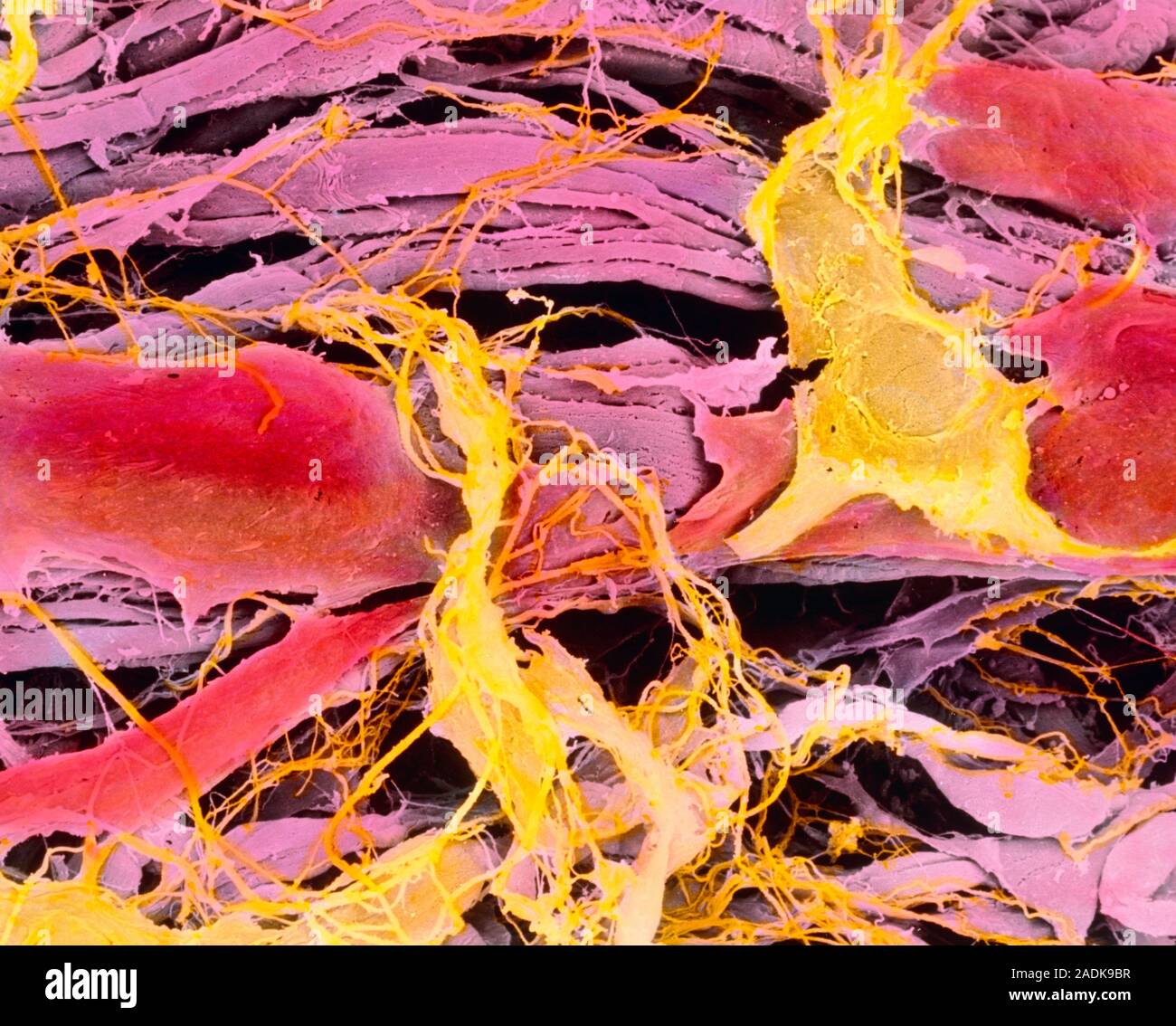 Der glatten Muskulatur in die Eileiter. Farbige Scanning Electron ...