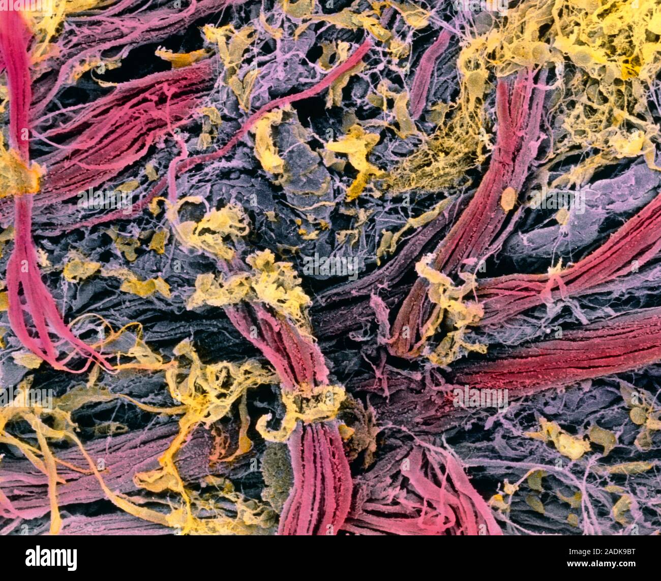 Der glatten Muskulatur in die Eileiter. Farbige Scanning Electron ...