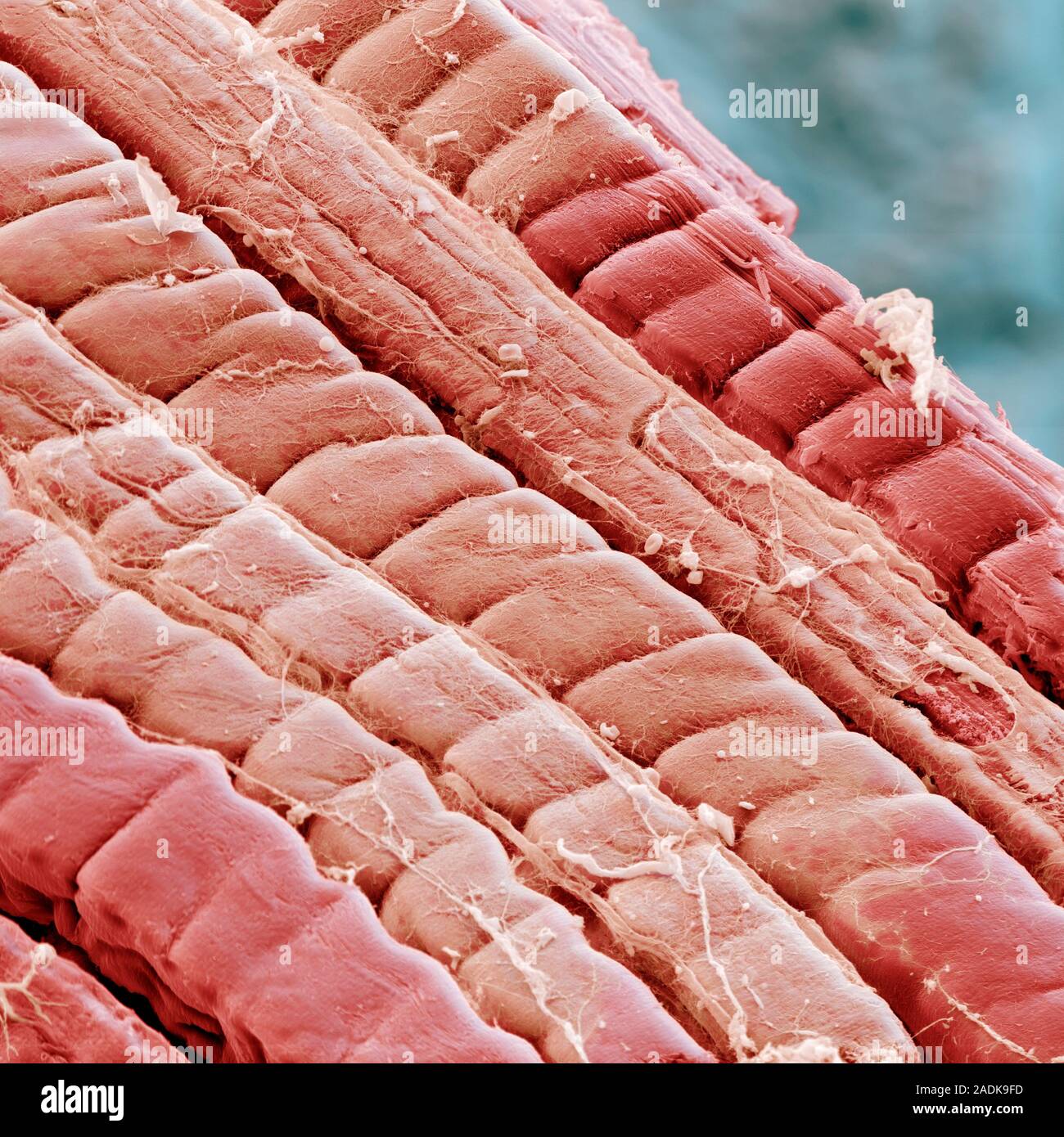 Der skelettmuskulatur. Farbige Scanning Electron Micrograph (SEM) der ...
