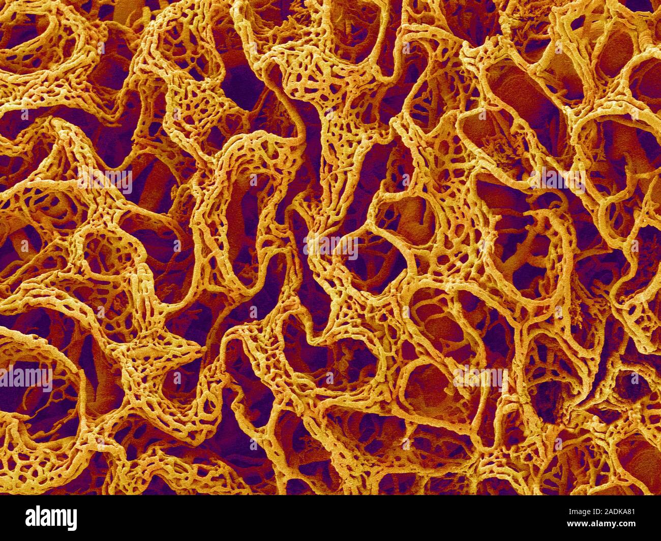 Die Blutgefäße. Farbige Scanning Electron Micrograph (SEM) der ...