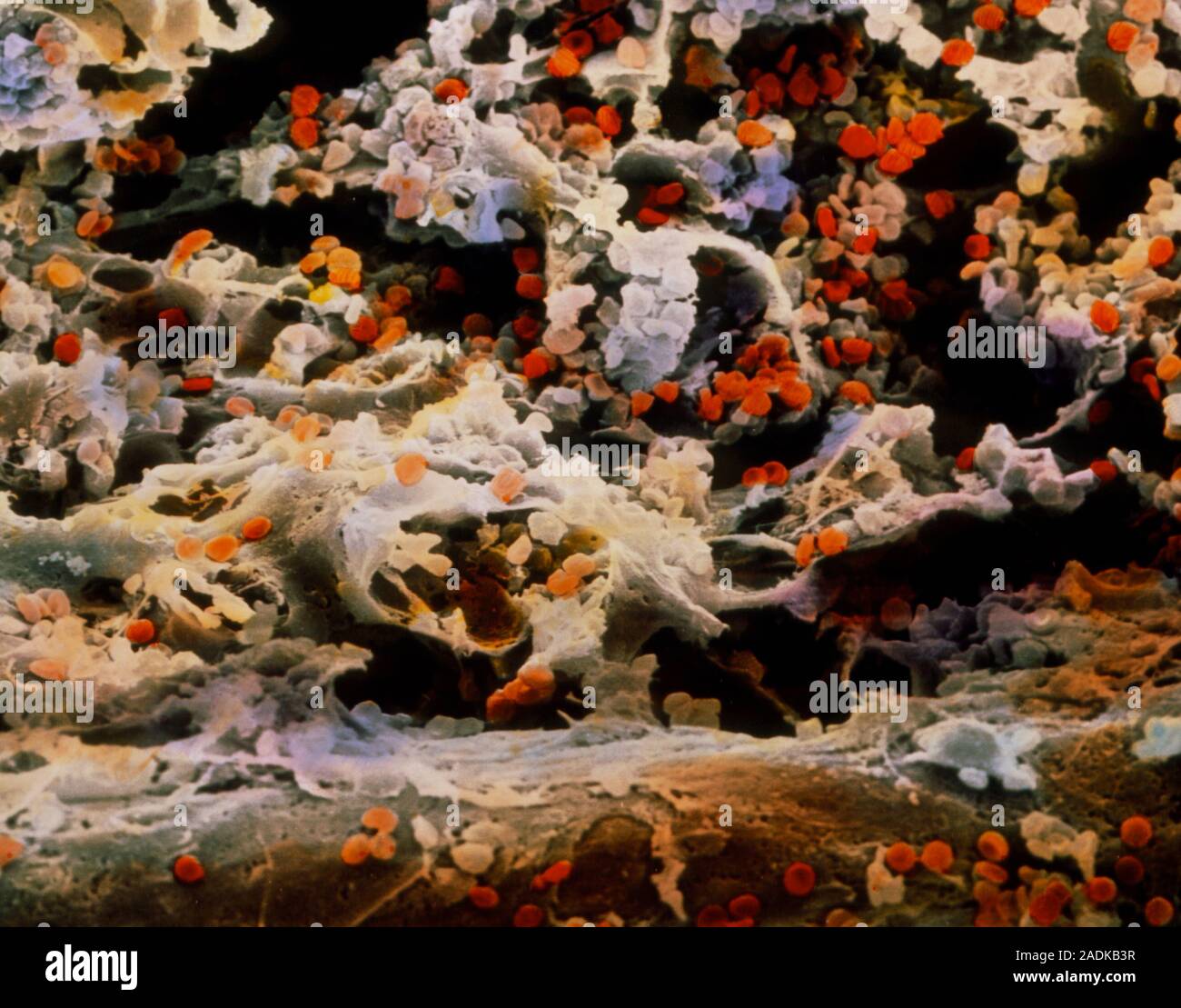 Knochenmark: false-color Scanning Electron Micrograph (SEM) von ...