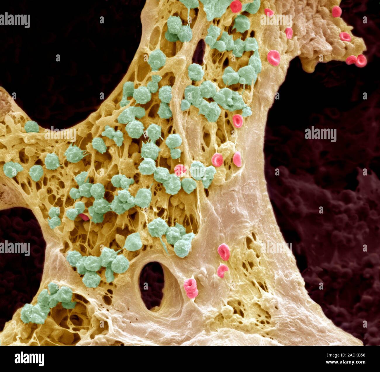 Knochenmark, Scanning Electron Micrograph (SEM). Knochenmark ist der ...