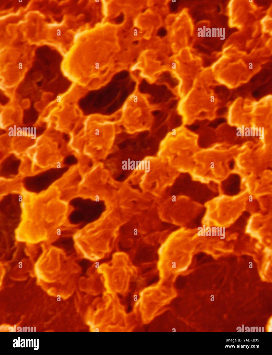 False - color Scanning Electron Micrograph (SEM) Der aggregrates der ...