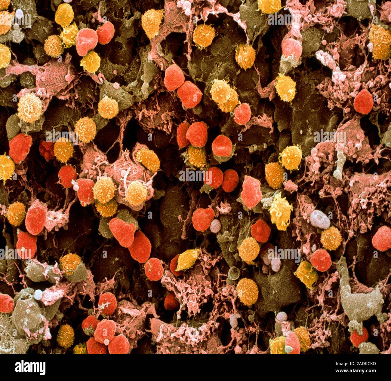 Lymphknoten. Farbige Scanning Electron Micrograph (SEM) eines freeze ...