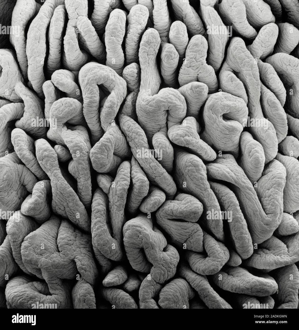 Scanning Electron Micrograph der Mauer des menschlichen Duodenum ...
